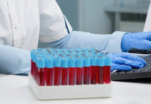 Pathology Test at your Home | Blood | Urine Test | Doorstep | Pune ...